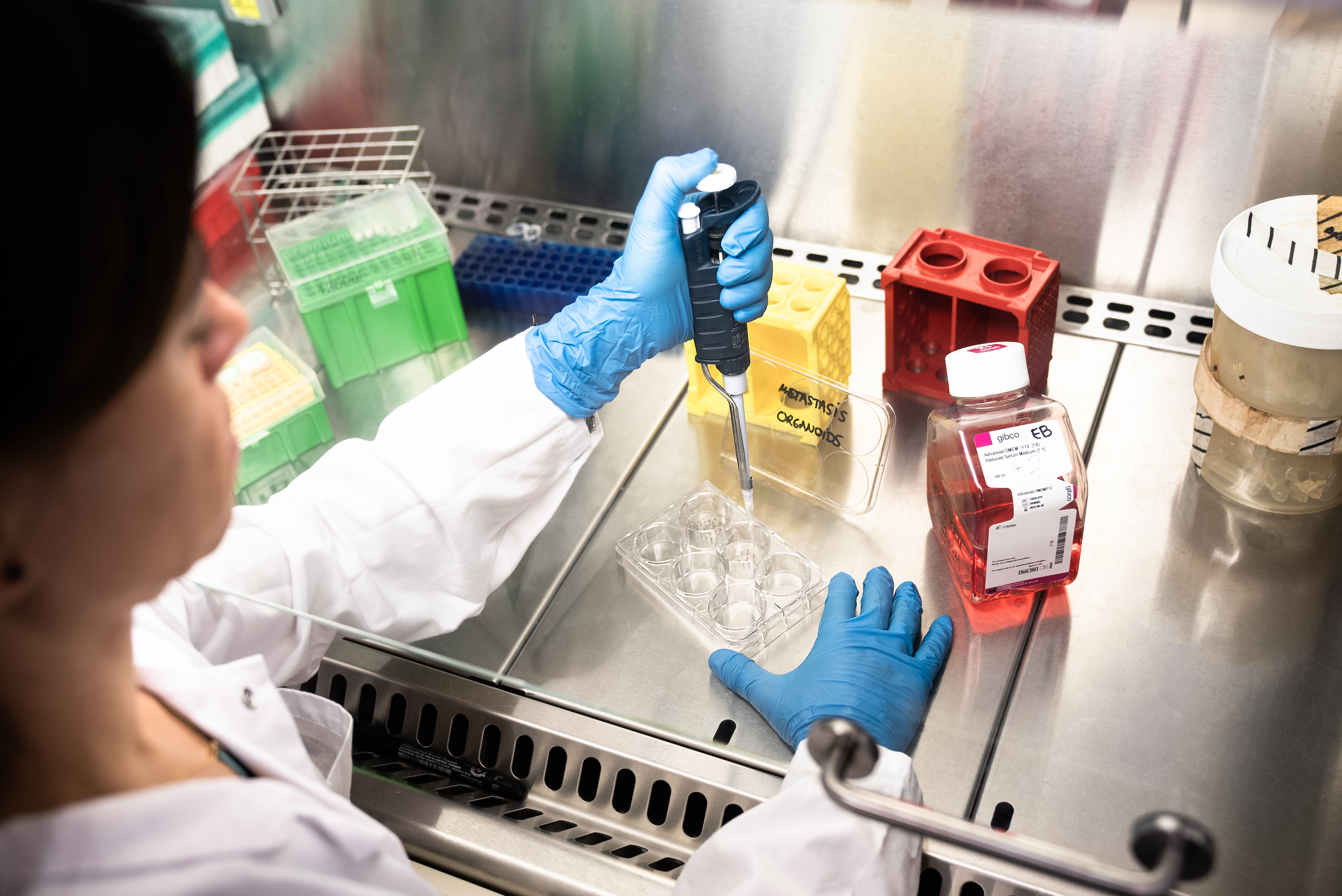 Colorectal cancer evades immunotherapy using a dual barrier | IRB Barcelona
